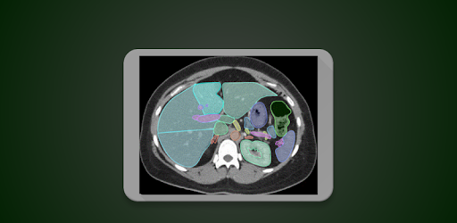 Radiology CT Anatomy for PC - How to Install on Windows PC, Mac