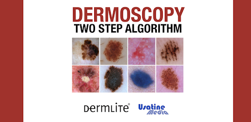 Dermoscopy Two Step Algorithm For Pc How To Install On Windows Pc Mac