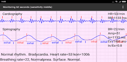 Cardio Spirograph F for PC - How to Install on Windows PC, Mac