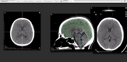 Imaging Anatomy - CT MRI XR US for PC - How to Install on Windows PC, Mac