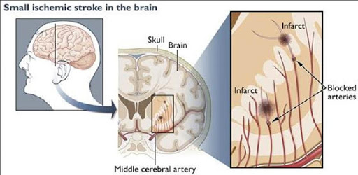 Different Strokes for PC - How to Install on Windows PC, Mac