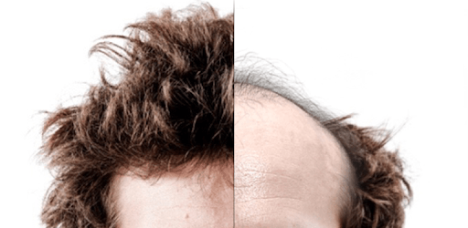 Baldify - Make yourself Bald for PC - How to Install on Windows PC, Mac