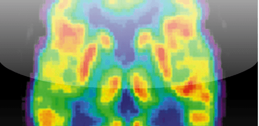 Radiology Core: Nuclear Med for PC - How to Install on Windows PC, Mac