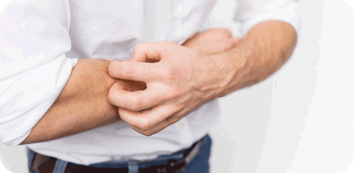 How to Get Rid of Itchy Skin for PC - How to Install on Windows PC, Mac